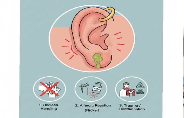 Infected Ear Piercing: Symptoms, Causes, Treatment